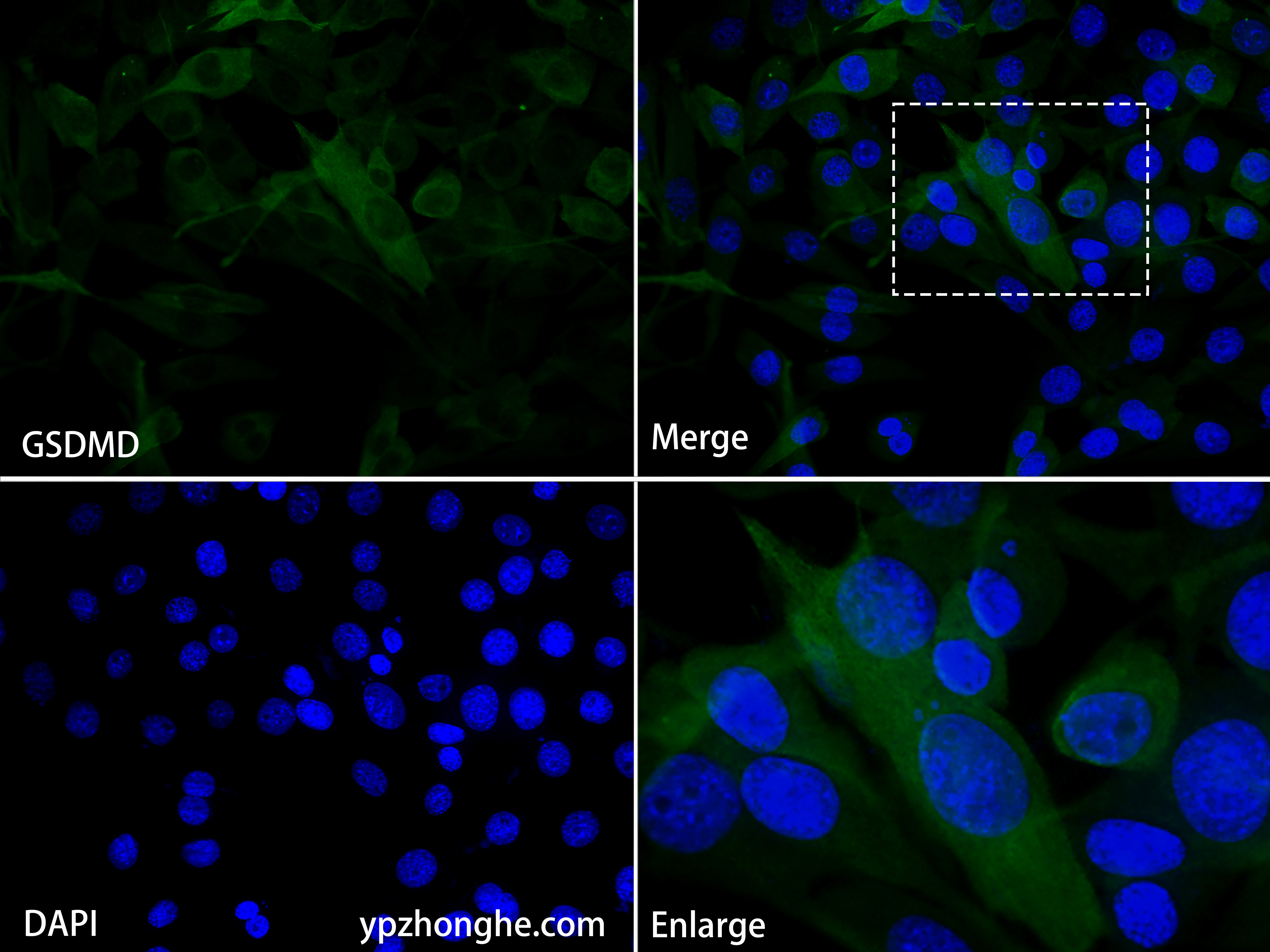Recombinant GSDMD N-terminal/Overall length Rabbit Monoclonal Antibody ...