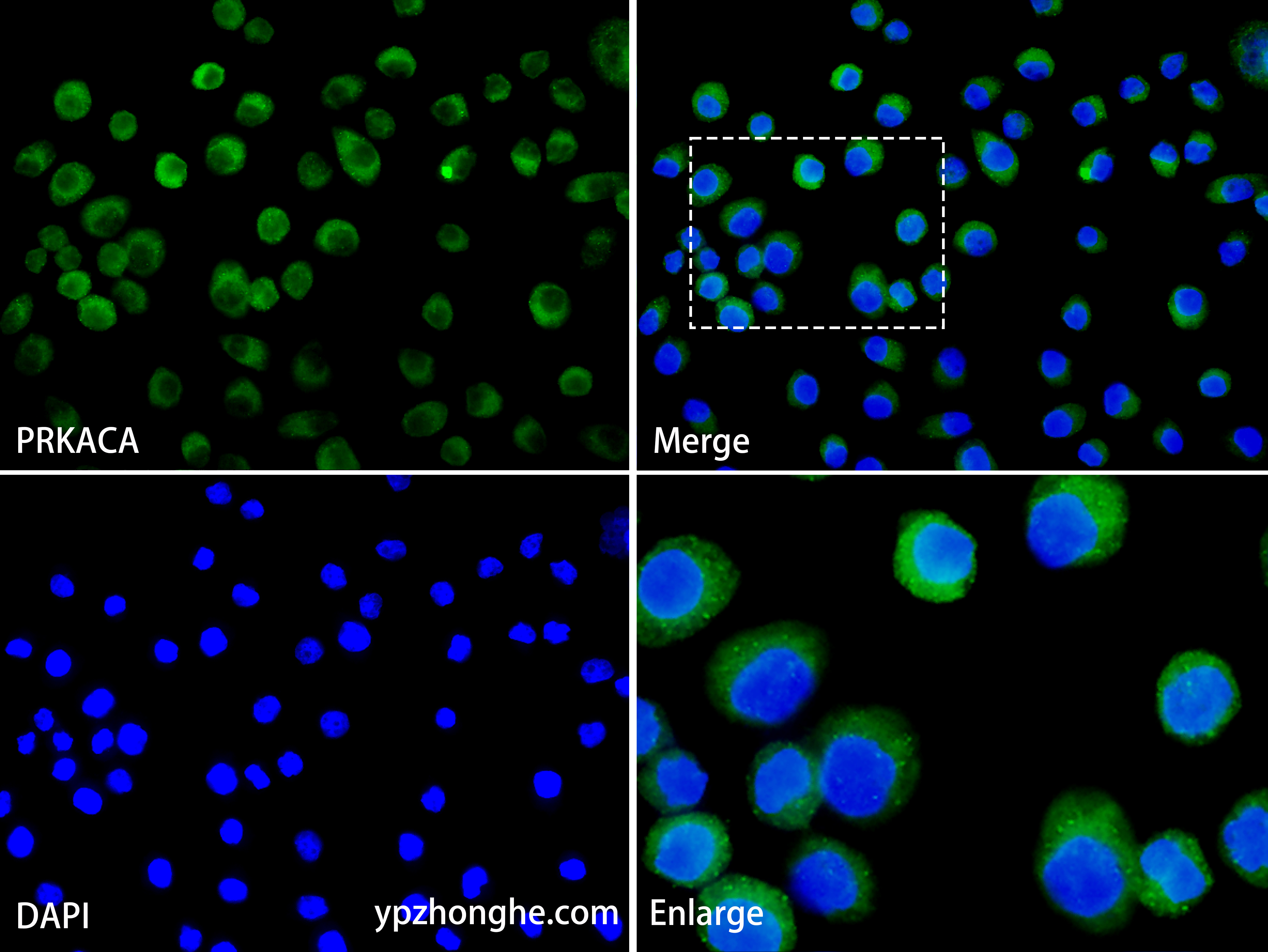Recombinant PRKACA Rabbit Monoclonal Antibody - 一品众合官网