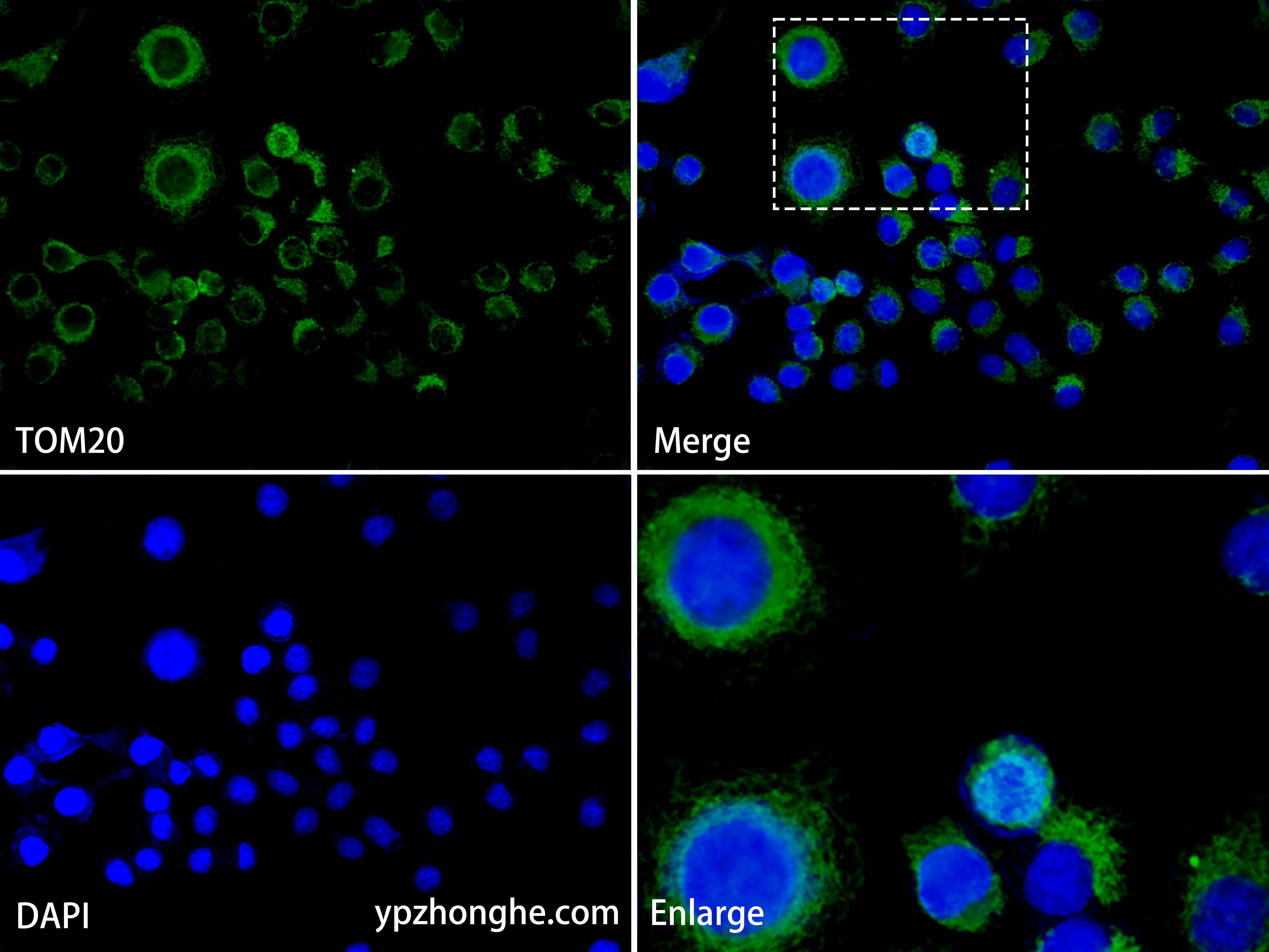 Recombinant TOM20 Rabbit Monoclonal Antibody - 一品众合官网