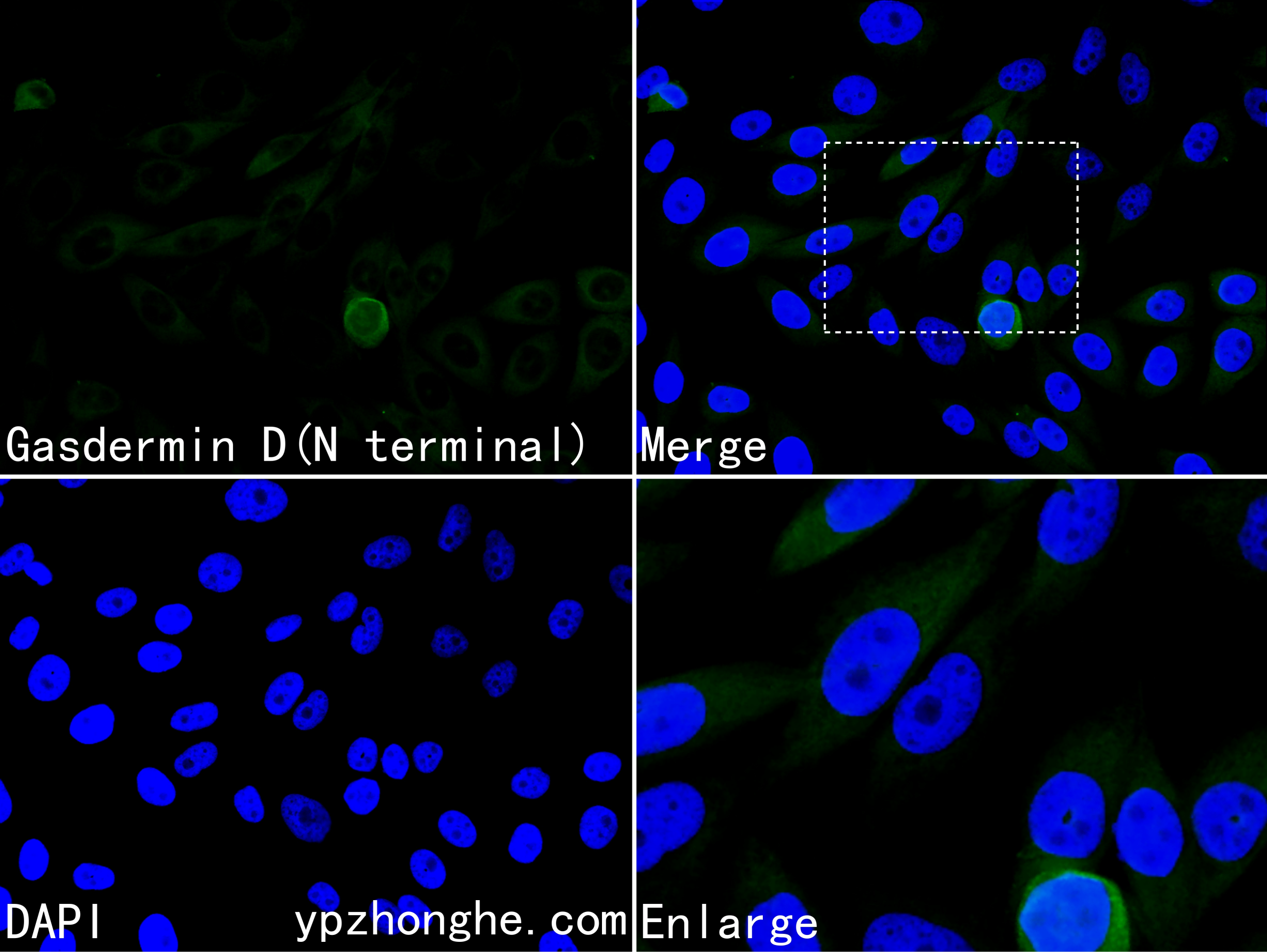 Recombinant Gasdermin D(N terminal)/Overall length Rabbit Monoclonal ...