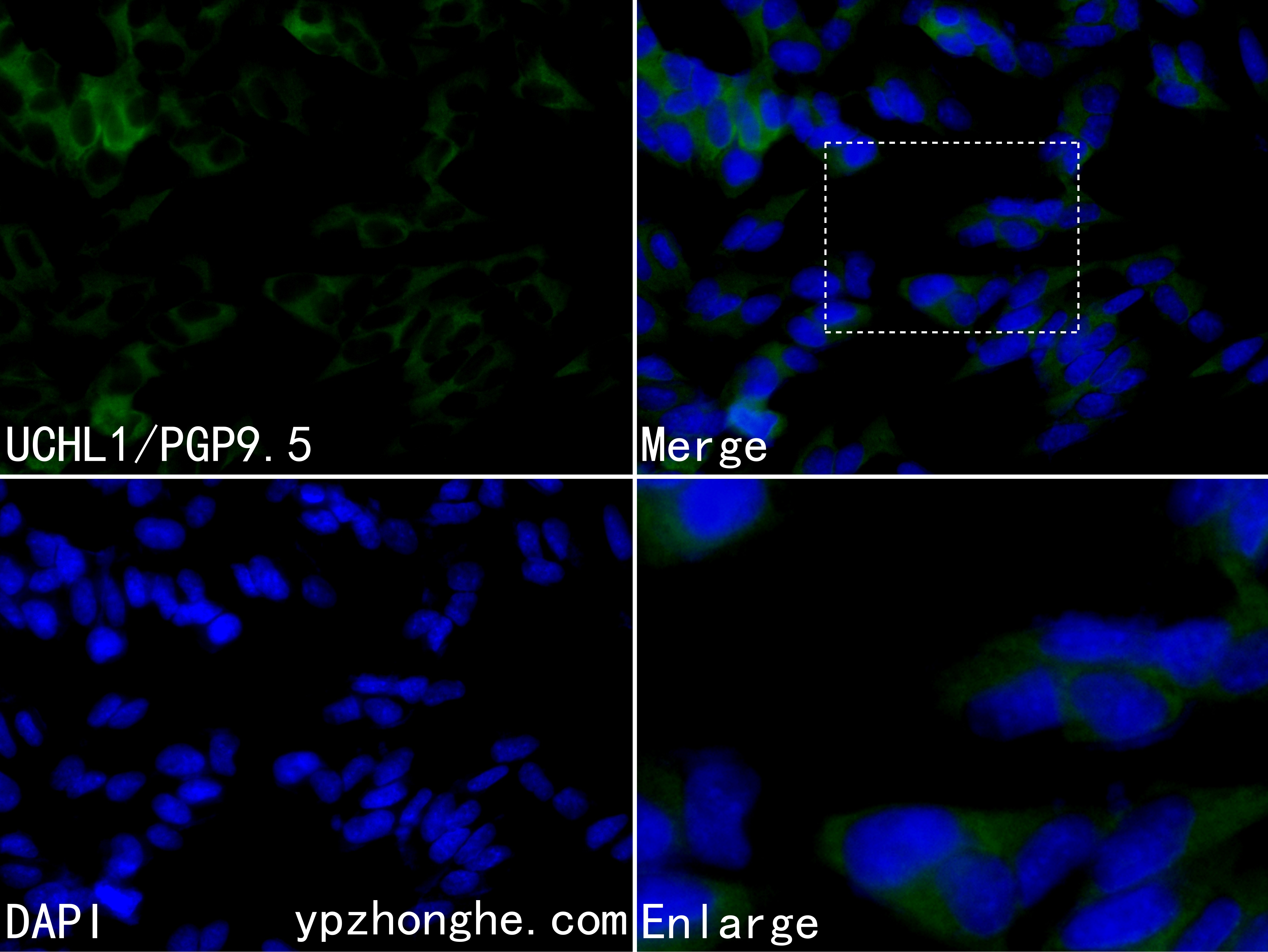Recombinant UCHL1/PGP9.5 Rabbit Monoclonal Antibody - 一品众合官网