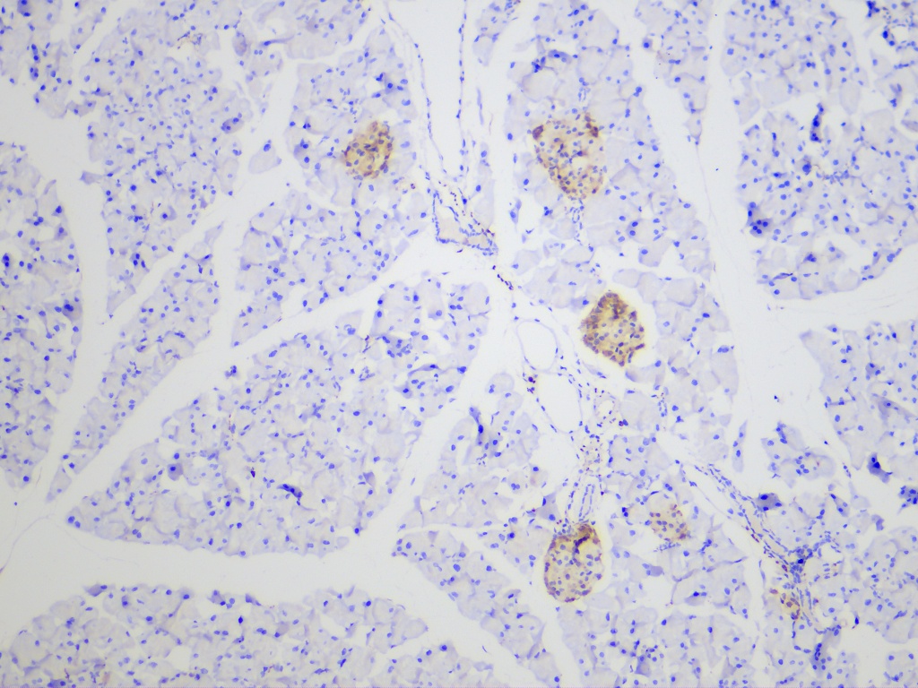 Recombinant UCHL1/PGP9.5 Rabbit Monoclonal Antibody - 一品众合官网