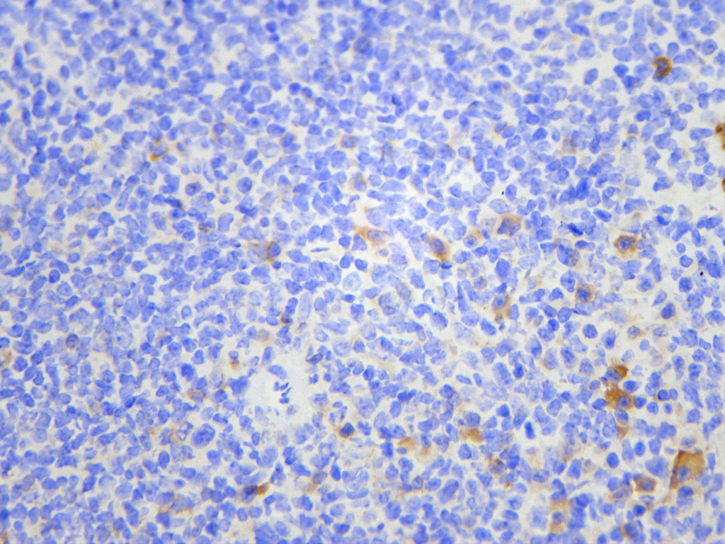Recombinant CCR2 Rabbit Monoclonal Antibody - 一品众合官网