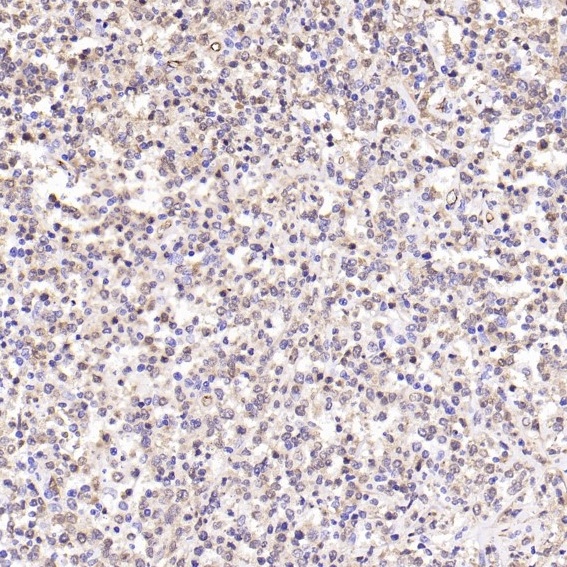 Recombinant PGP9.5 Rabbit Monoclonal Antibody - 一品众合官网
