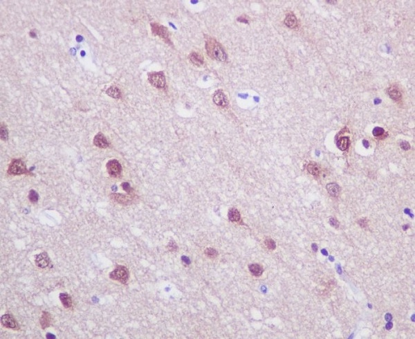 Recombinant PGP9.5 Rabbit Monoclonal Antibody - 一品众合官网