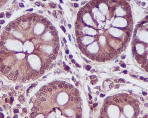 Recombinant LDHA Rabbit Monoclonal Antibody - 一品众合官网