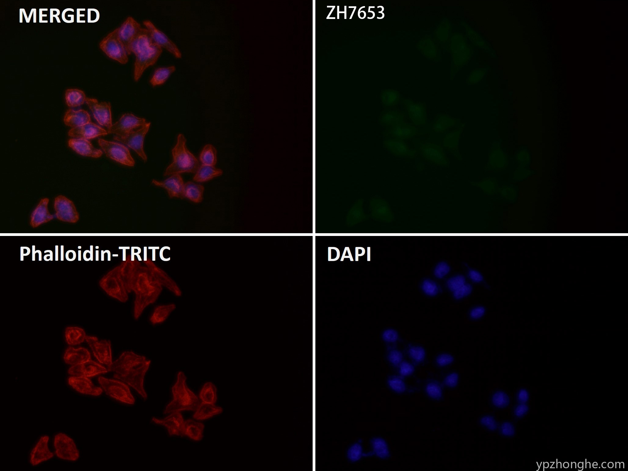 Recombinant p21 CDKN1A Rabbit Monoclonal antibody - 一品众合官网